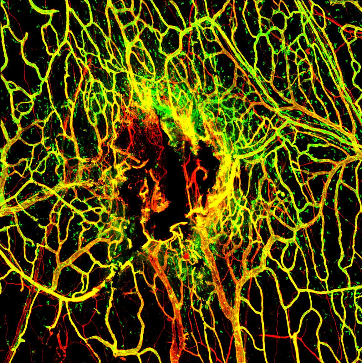 Infection hinders blood vessel repair following traumatic brain or ...