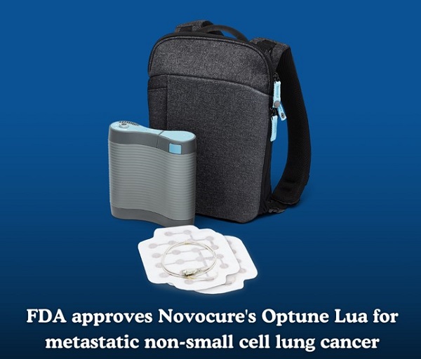 FDA Approves Tumor Treating Fields Device (Optune Lua) for Metastatic ...