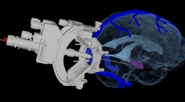 Mayo Clinic researchers lead transformative shift toward ...